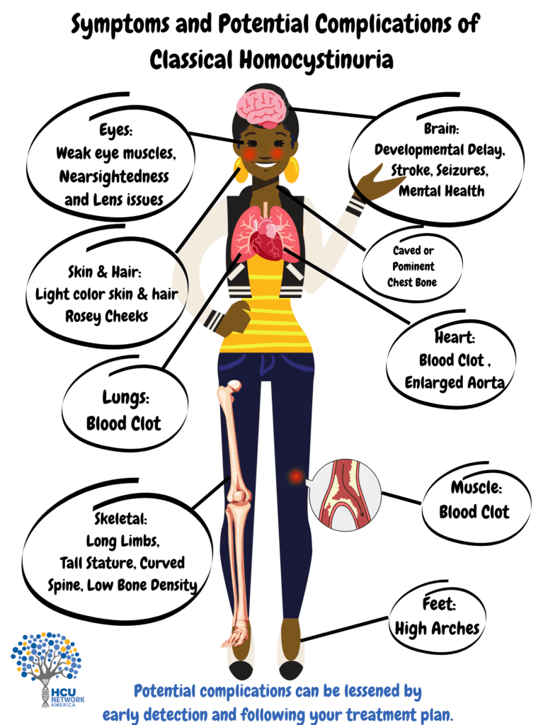 Basics of Homocystinuria - HCU Network America