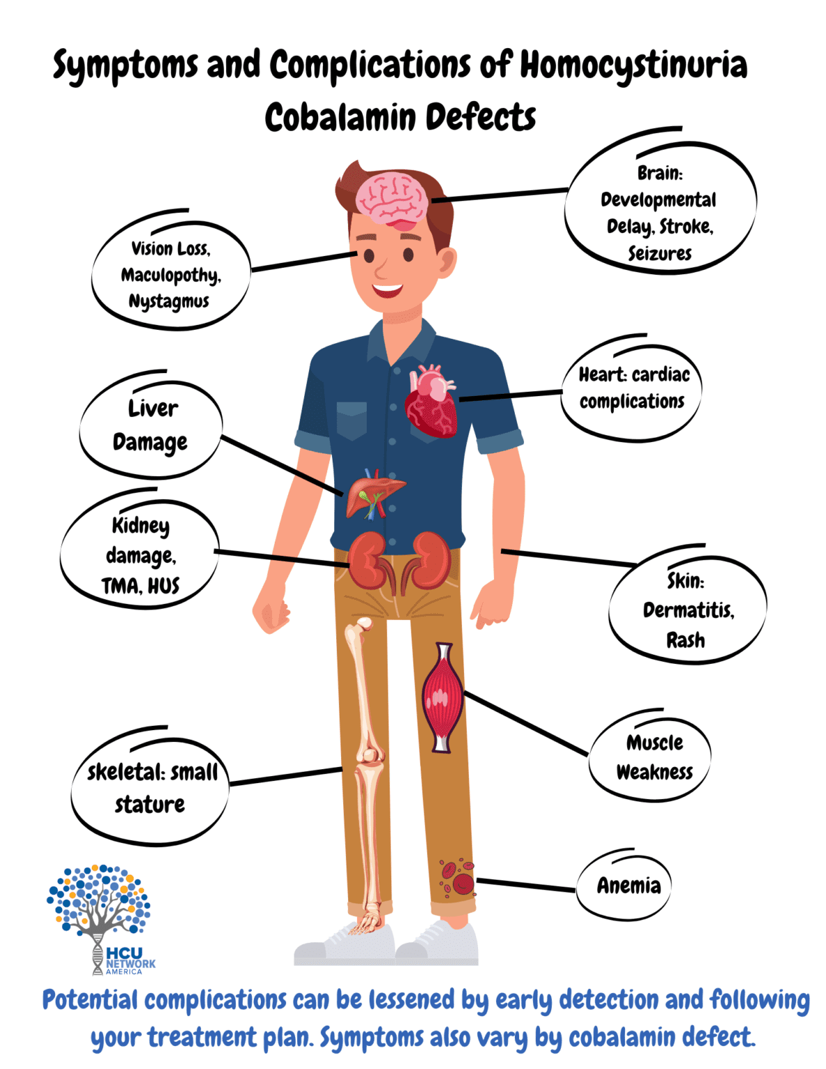 Basics of Homocystinuria - HCU Network America