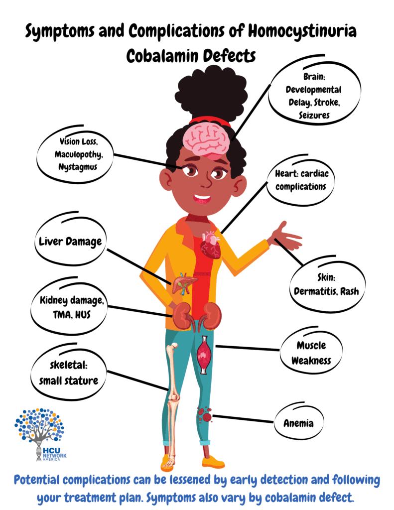 Basics of Homocystinuria - HCU Network America